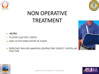 Radial head fracture | PPT