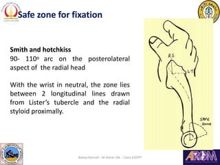 Radial head fracture | PPT