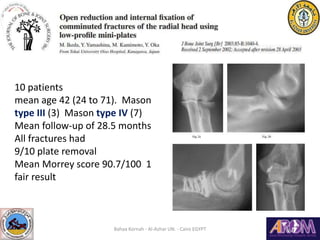 Radial head fracture | PPT