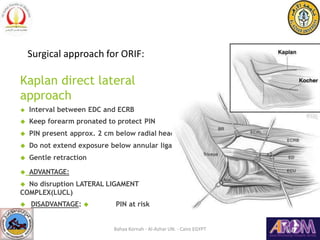 Radial head fracture | PPT