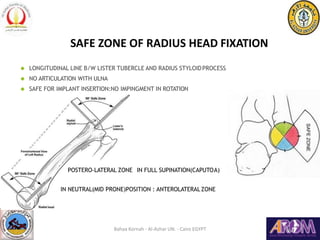 Radial head fracture | PPT