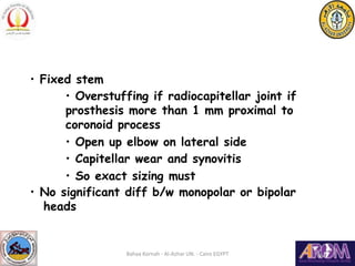 Radial head fracture | PPT