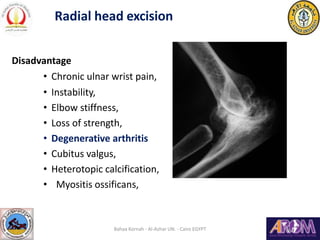 Radial head fracture | PPT