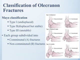 radial head fracture_and OLECRANONfracture.pptx