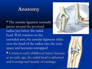 Radial head subluxation “nursemaids’ elbow” | PPT