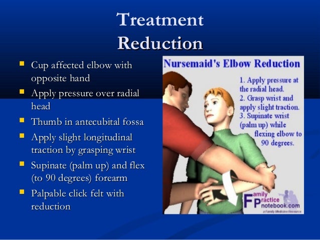 Radial head subluxation “nursemaids’ elbow”