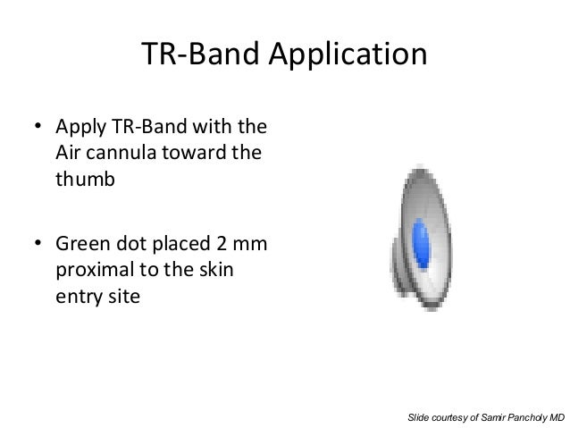 Rao SV - Radial hemostasis
