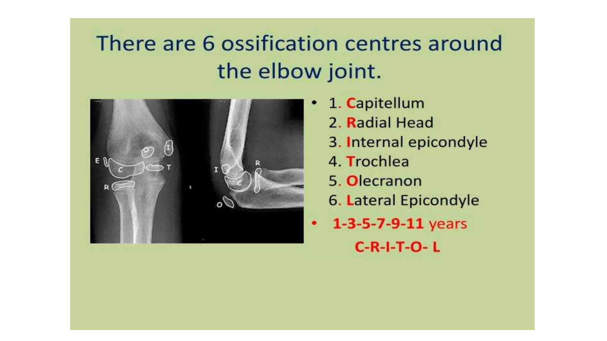 Radial neck fracture | PPTX