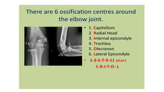 Radial neck fracture | PPTX
