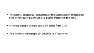 Radial neck fracture | PPTX
