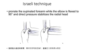 Radial neck fracture | PPTX