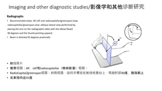 Radial neck fracture | PPTX