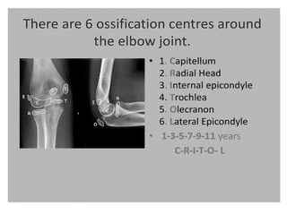 Radial neck fractures in childrens..pptx