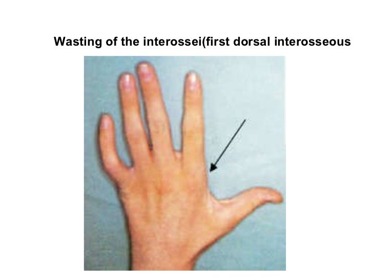 orthopedics.Radial nerve.(dr.baxtiar rasul)