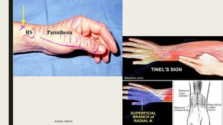 Radial nerve Course, Clinical Implications Assessment and Physiotherapy ...