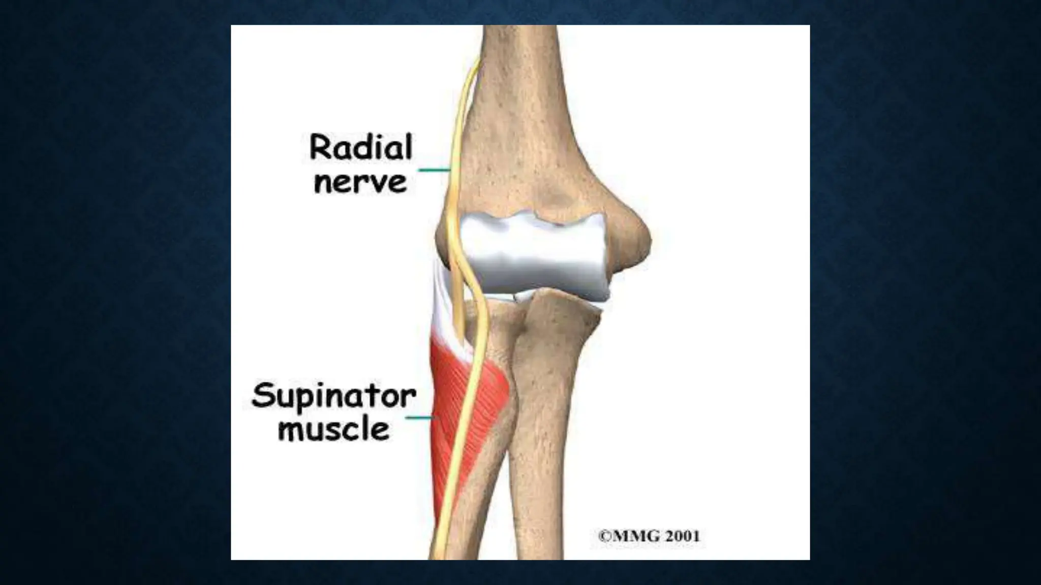 Radial Nerve and radial system education | PPT