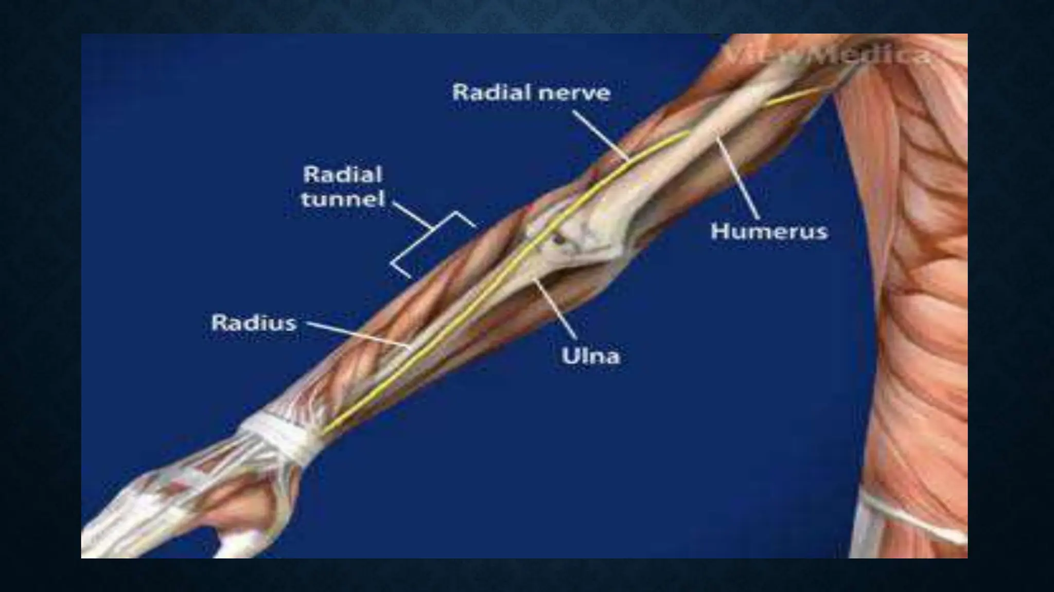 Radial Nerve and radial system education | PPT