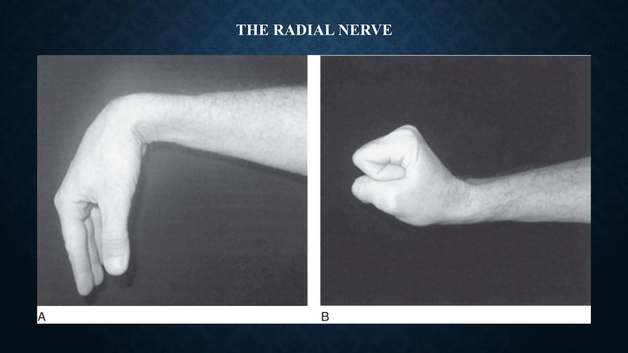 Radial Nerve and radial system education | PPT