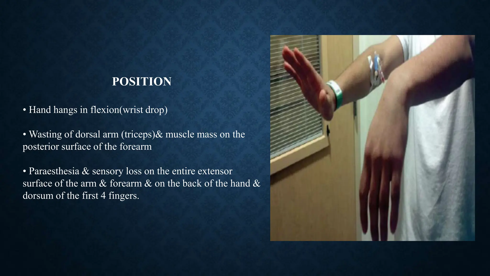 Radial Nerve and radial system education | PPT