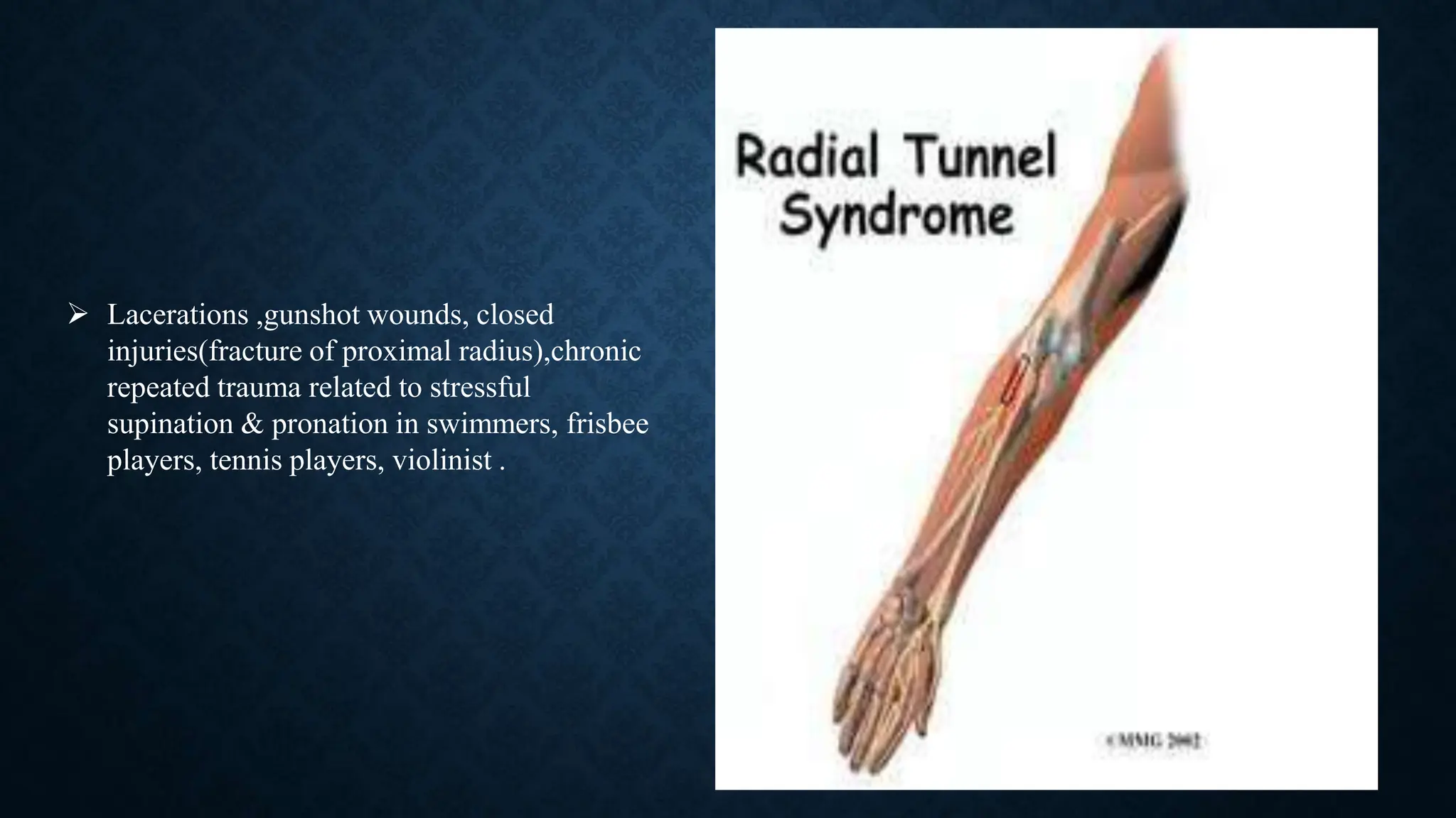 Radial Nerve and radial system education | PPT
