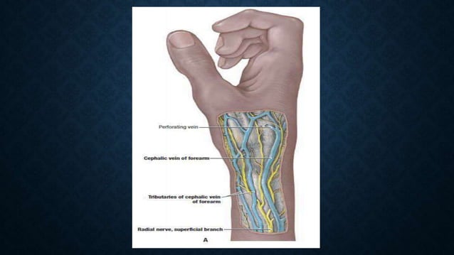 Radial Nerve and radial system education | PPT