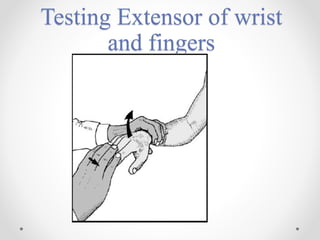 Radial nerve palsy, orthopaedics | PPTX