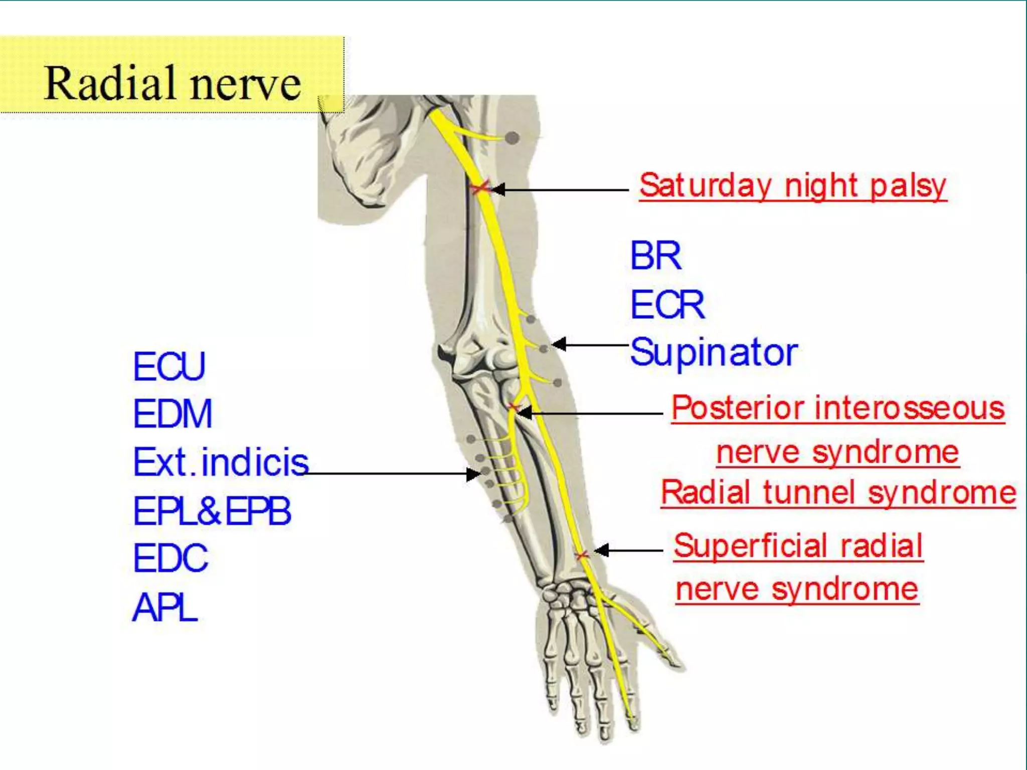 Radial nerve entrapment | PPT
