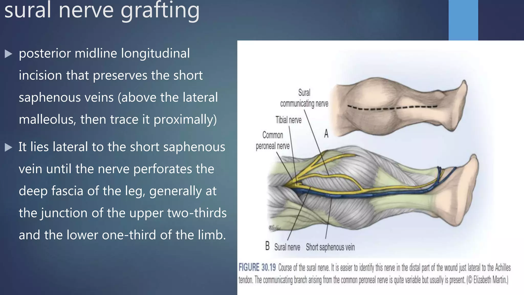 Radial nerve anatomy and injuries | PPTX