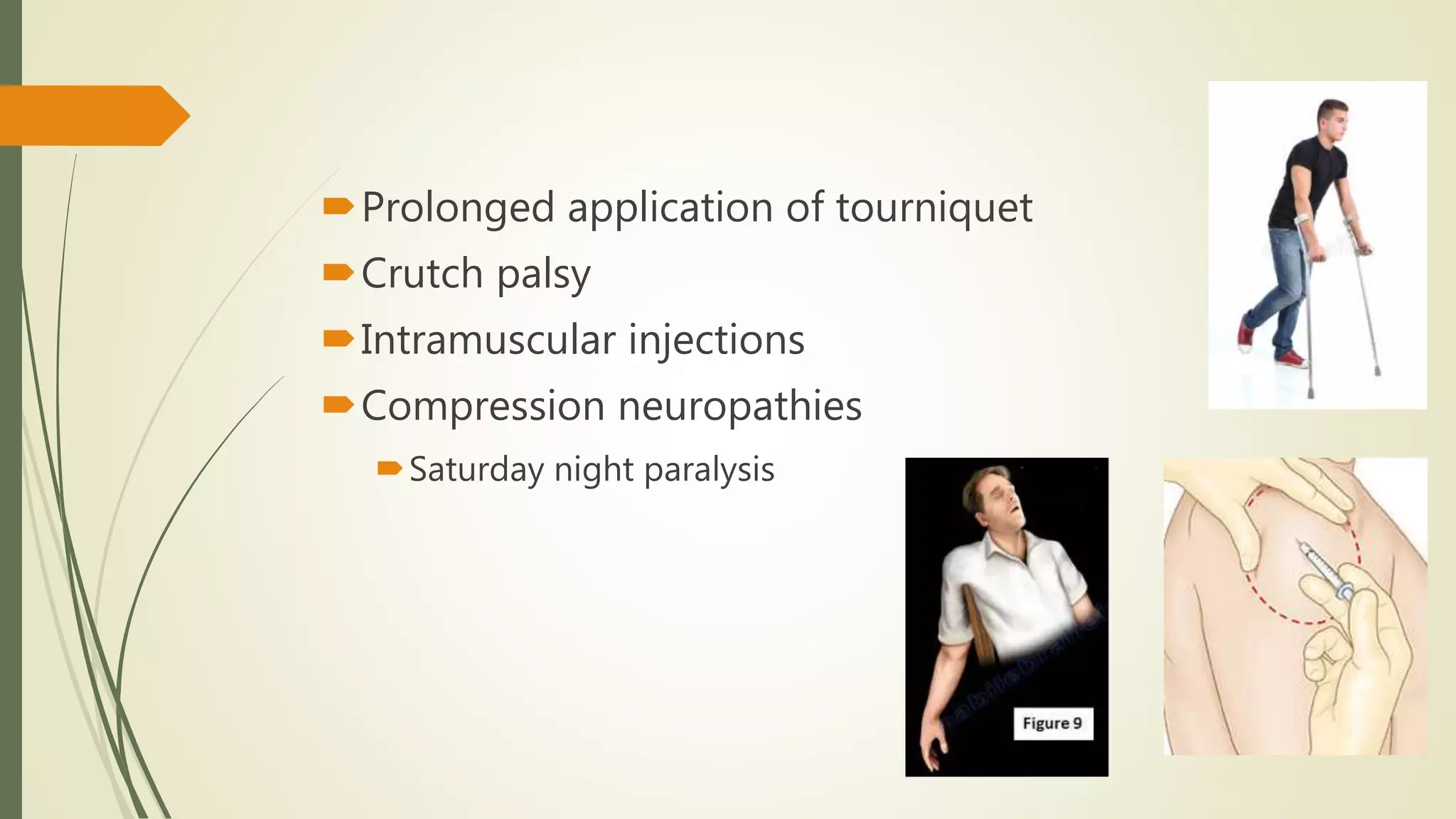 Radial nerve injury | PPTX
