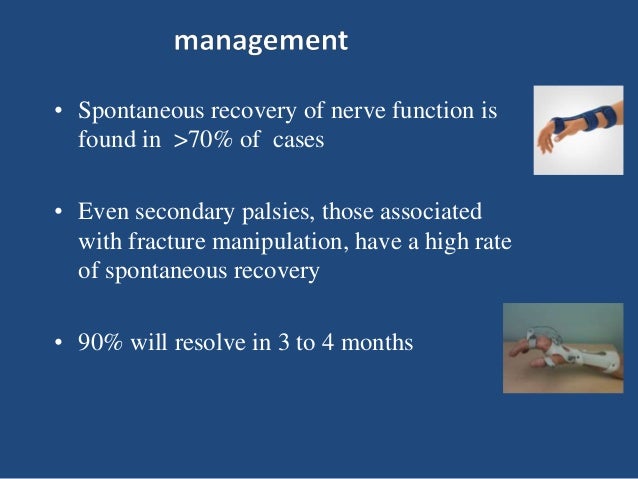 Radial Nerve Palsy