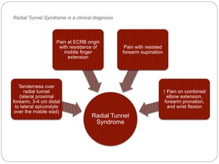 Radial nerve palsy | PPTX