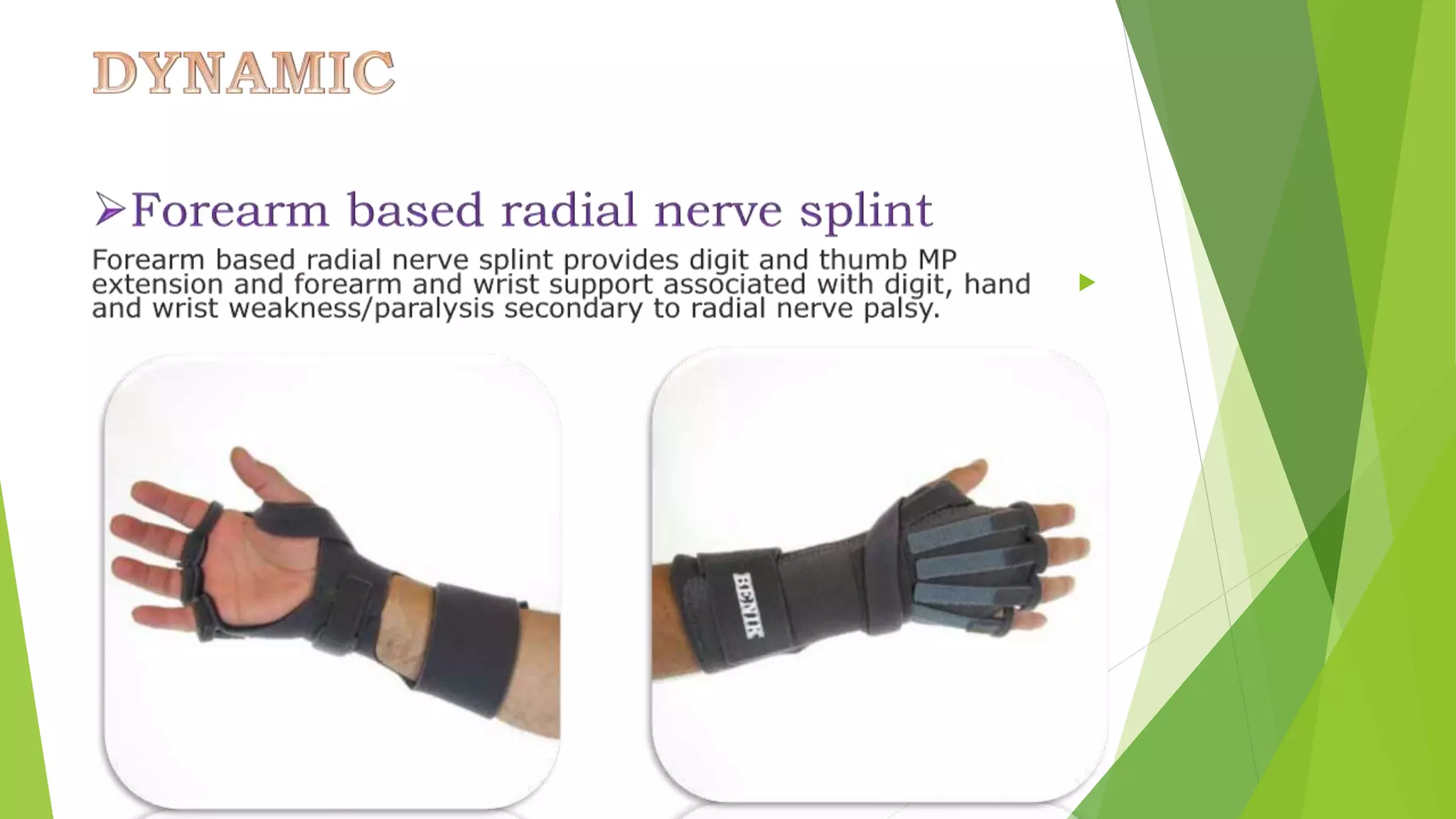 Radial nerve palsy | PPTX