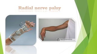 Radial nerve palsy | PPTX