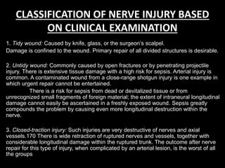 RADIAL NERVE palsy.pptx
