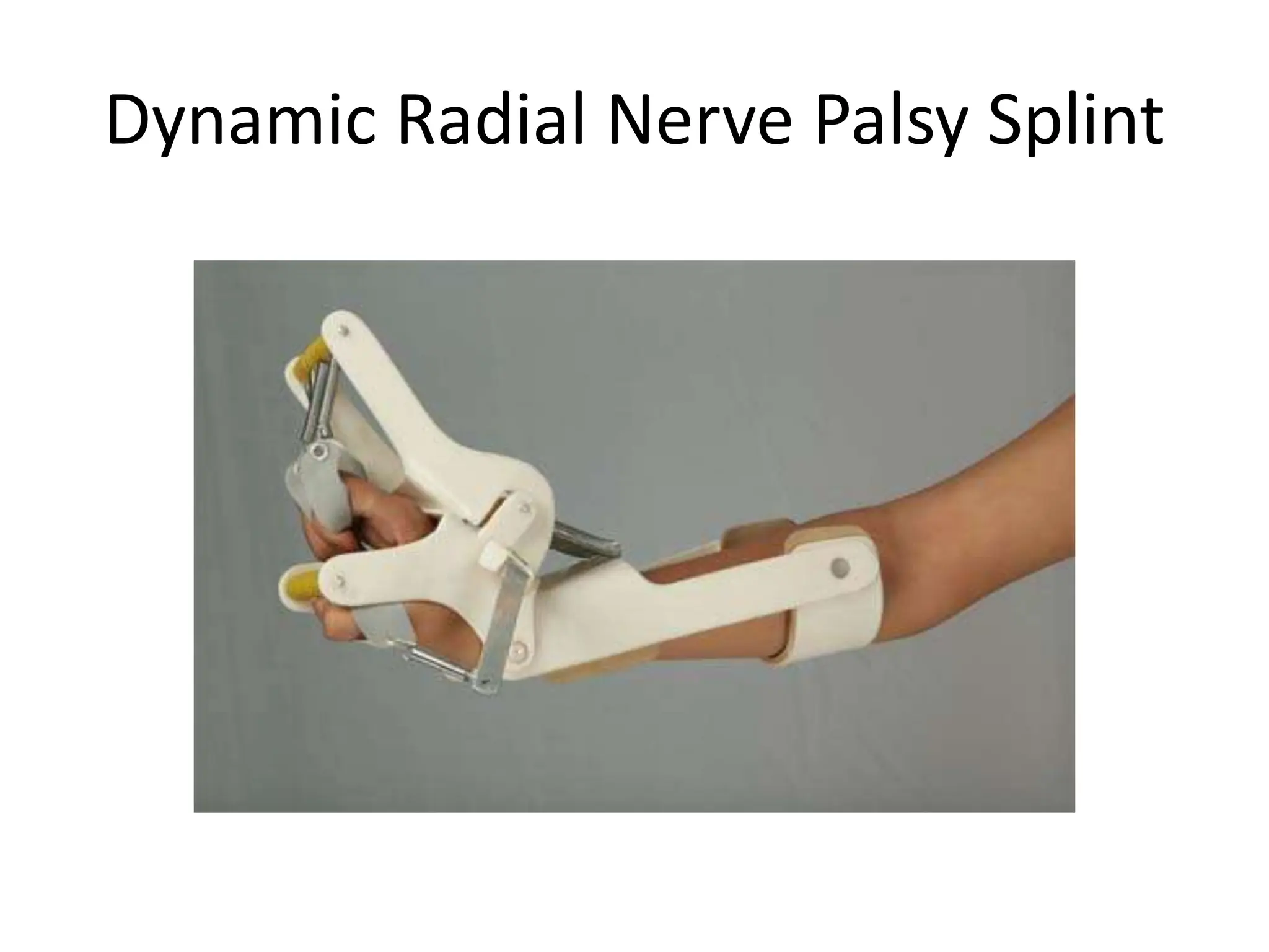 Radial Nerve palsy, Anatomy, Diagnosis and Management.pptx