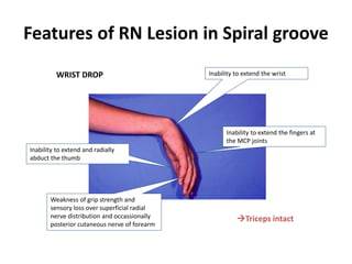 Radial Nerve palsy, Anatomy, Diagnosis and Management.pptx