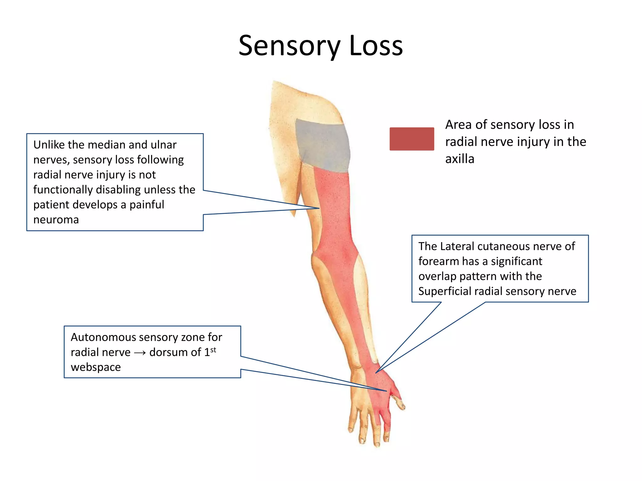Radial nerve palsy clinical features and diagnosis | PPTX
