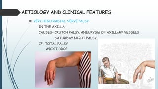 RADIAL NERVE PALSY[1].pptx