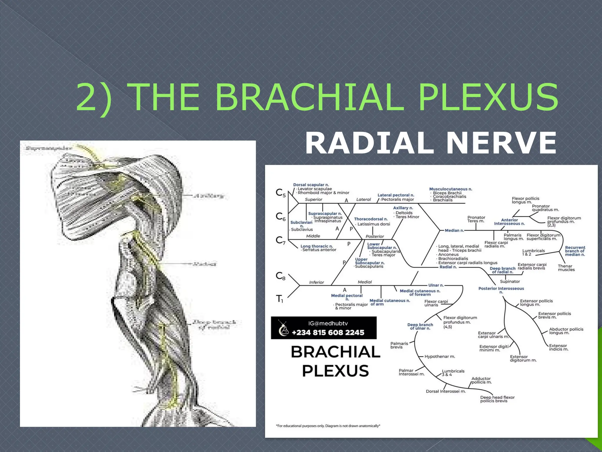 Radial Nerve Presentation , nerve of brachial plexus | PPTX | Death ...