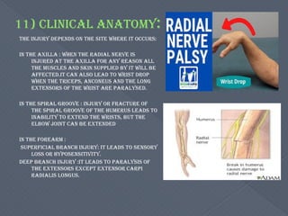 Radial Nerve Presentation , nerve of brachial plexus | PPTX