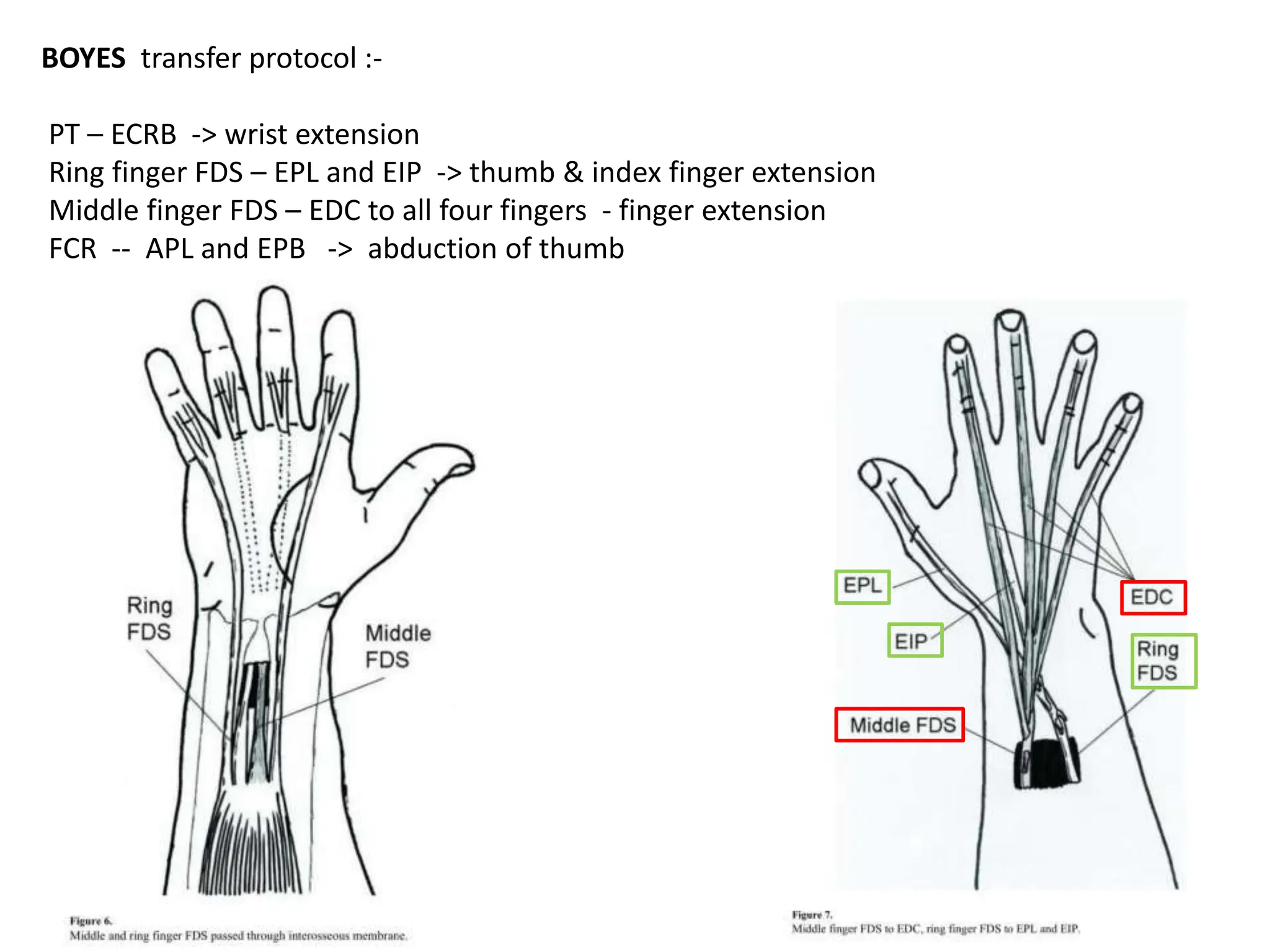 Radial nerve tendon | PPTX