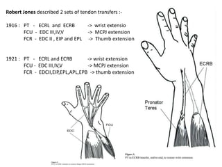 Radial nerve tendon | PPTX | Death, Injury, or Military Conflict ...