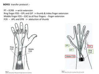 Radial nerve tendon | PPTX | Death, Injury, or Military Conflict ...