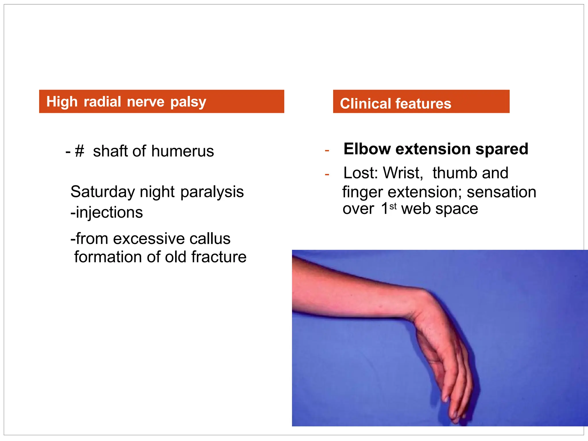 RADIAL NERVE Injuries usefu for Undergraduates | PPTX
