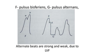 Clinical examination of Radial pulse by Pandian M, Tutor, Dept of ...