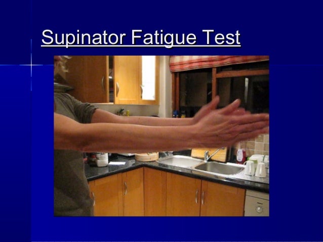 Radial tunnel syndrome