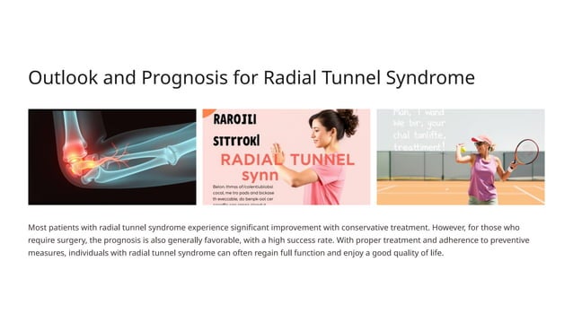 Radial Tunnel Syndrome symptoms and signs | PPT
