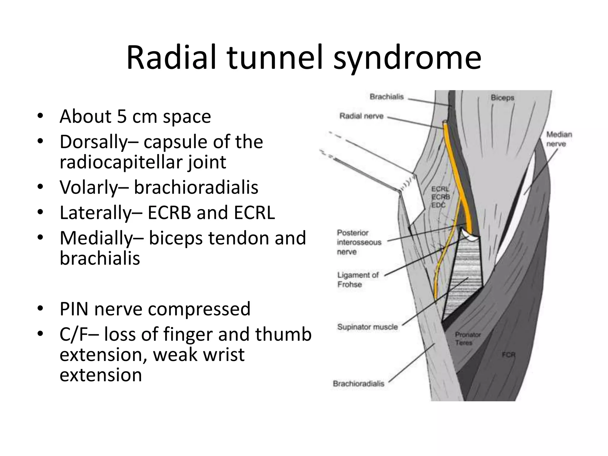 Radial, ulnar and median nerve injuries | PPTX