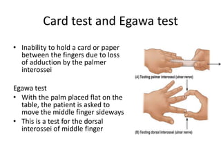 Radial, ulnar and median nerve injuries | PPT