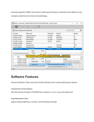 RadiAnt DICOM Viewer 2023.1 PC Software – WhizzNews.pdf